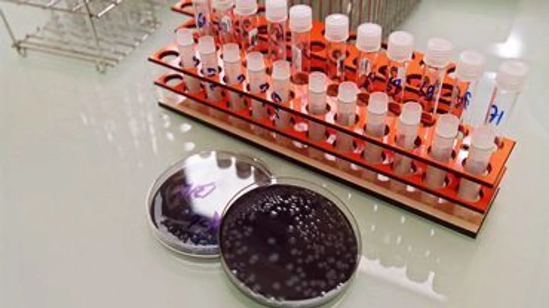 Légionellose : comprendre l’infection, son histoire et sa résurgence en ...