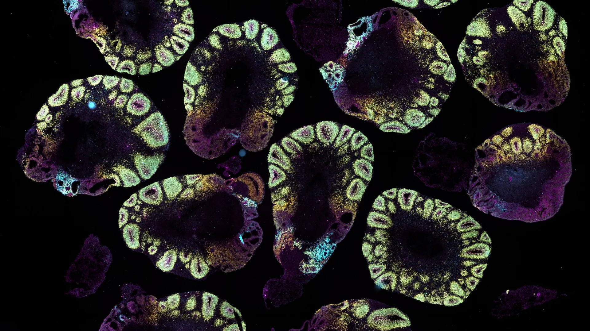 Les organoïdes : ce monde miniature qui imite nos organes - RTBF Actus