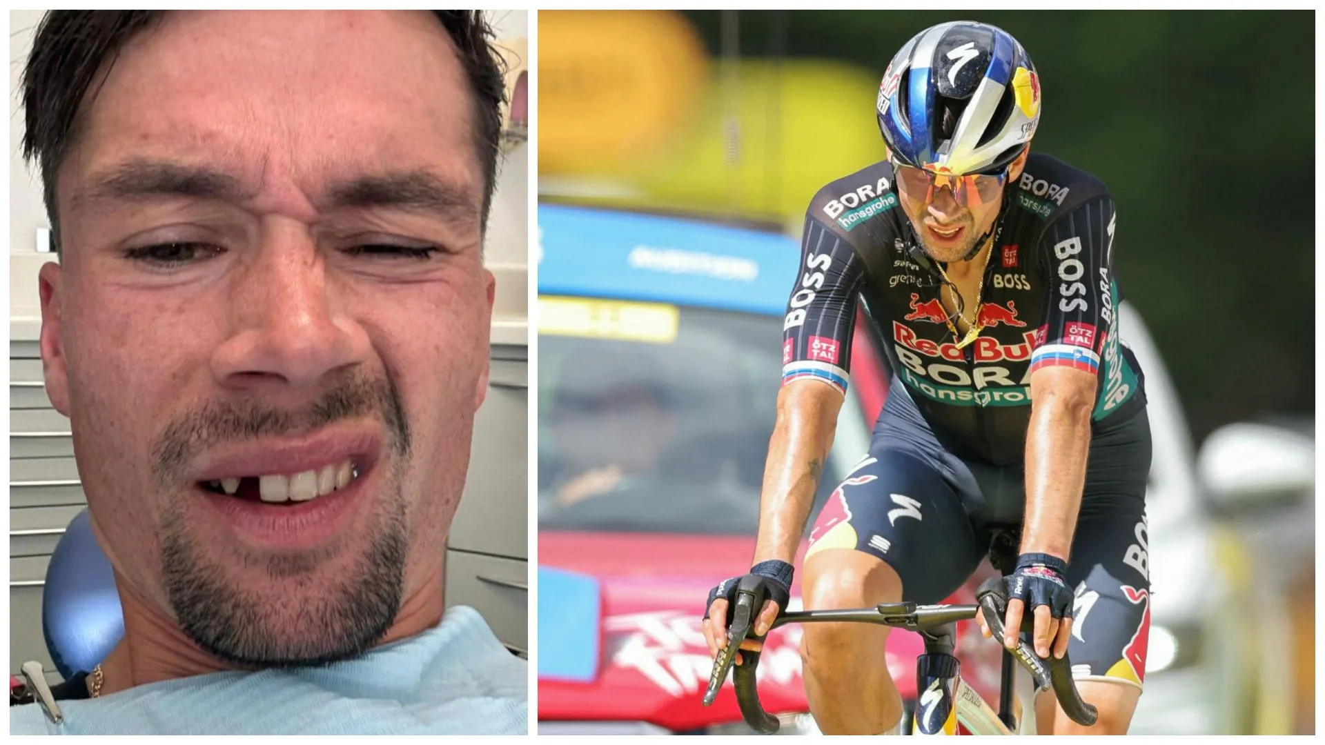 'Ça commence bien…' : Primoz Roglic s’affiche avec une dent en moins ...