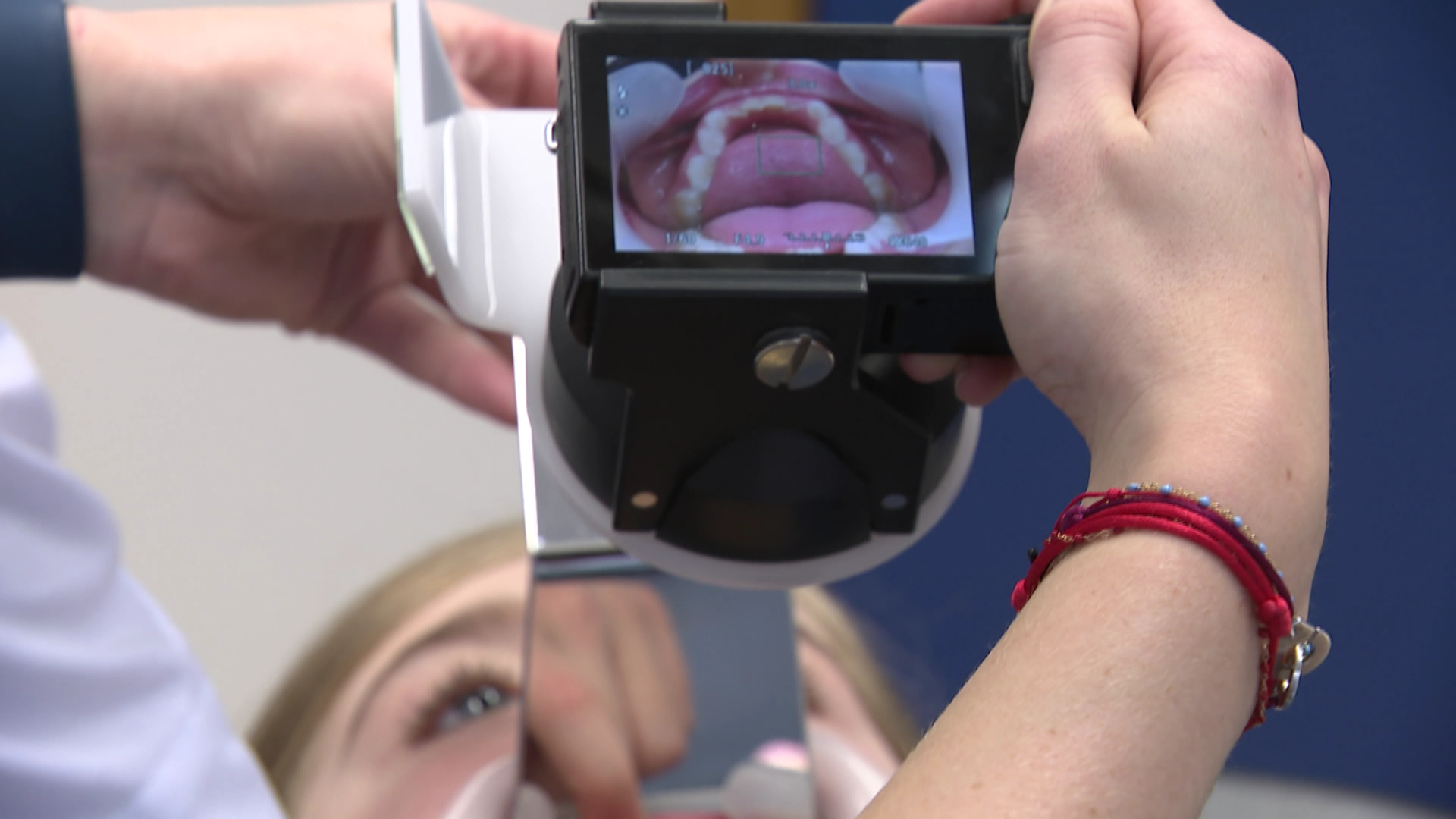 Toujours plus chers… Les coûts des soins orthodontiques inquiètent la ...