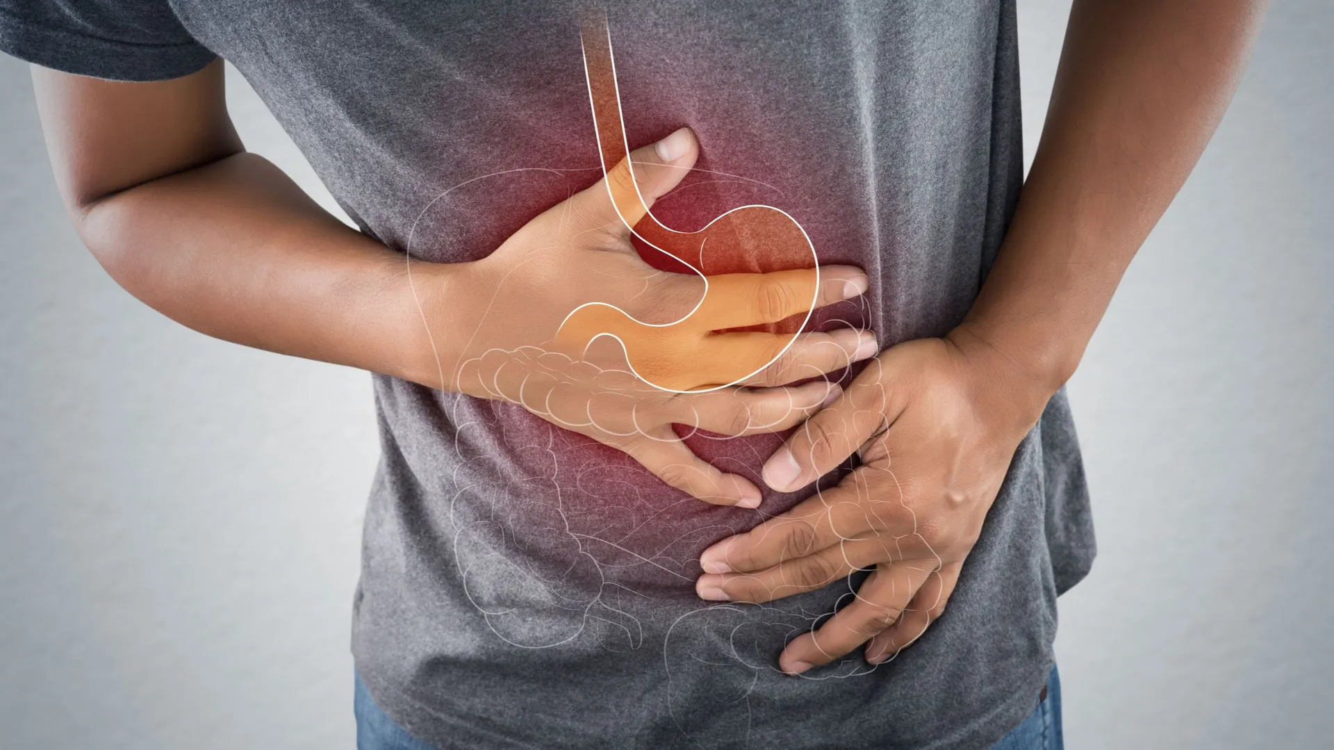 Maladie de Crohn : 5 choses à savoir sur cette maladie inflammatoire ...