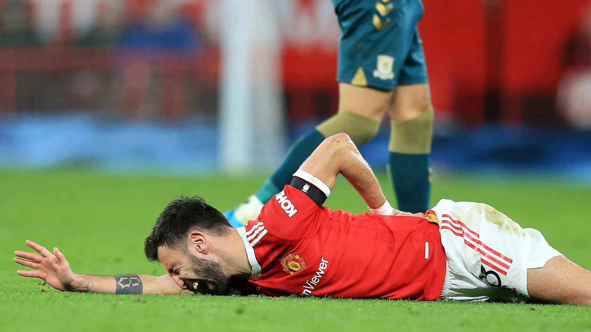 Calendrier surchargé : les blessures en hausse de 20% dans le foot ...