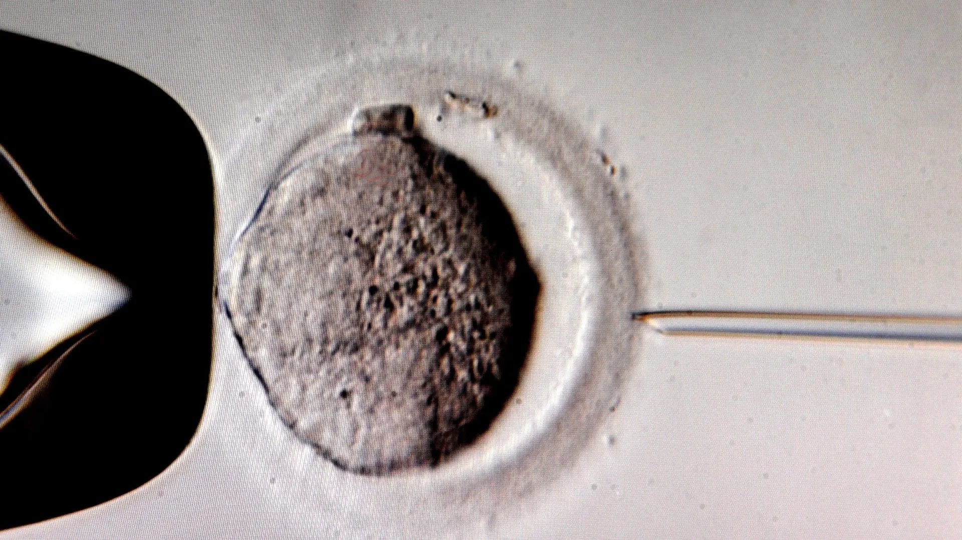 La congélation d'ovules et de sperme dorénavant remboursée pour les ...
